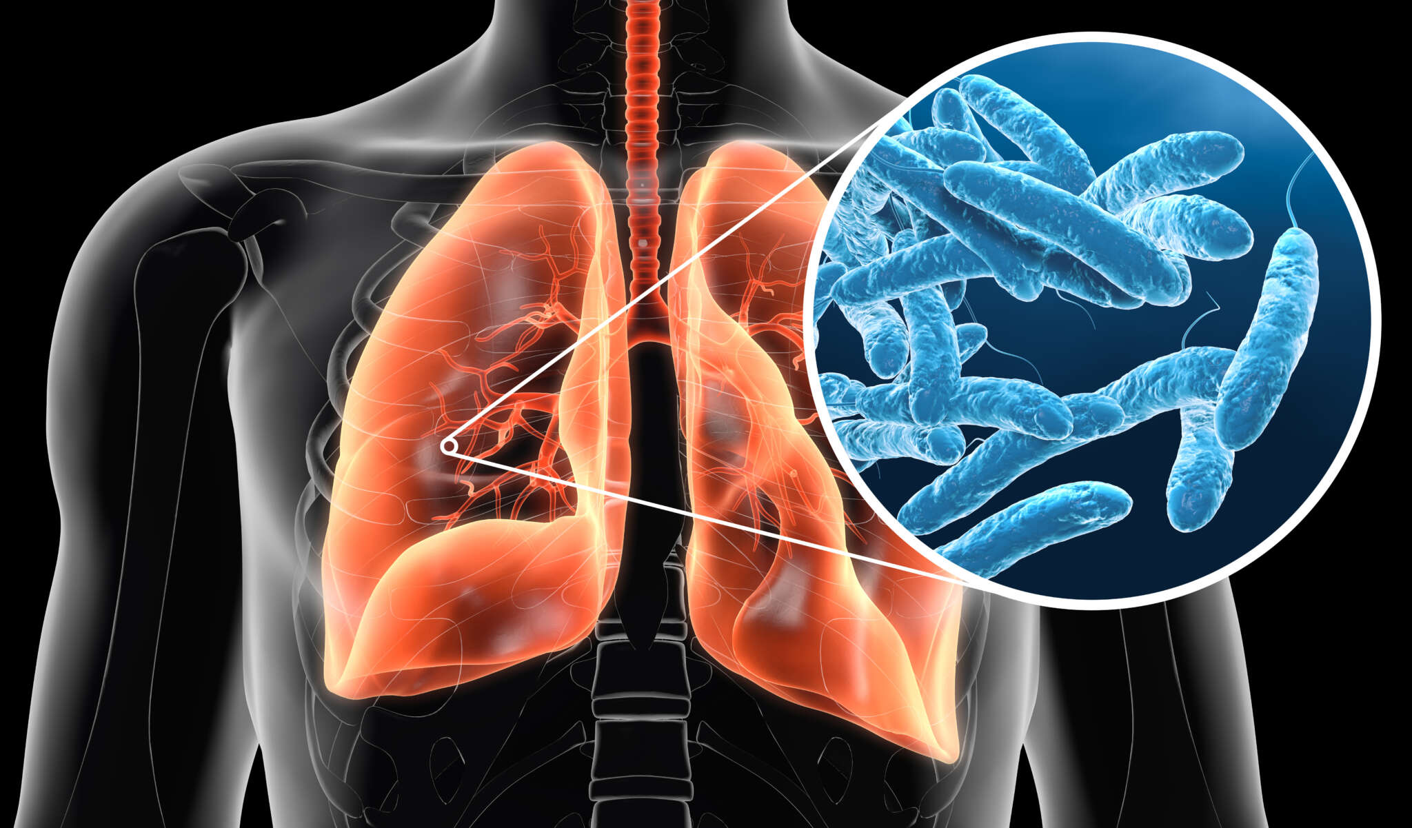 Legionella Risk Assessment - Midlands Legionella Control